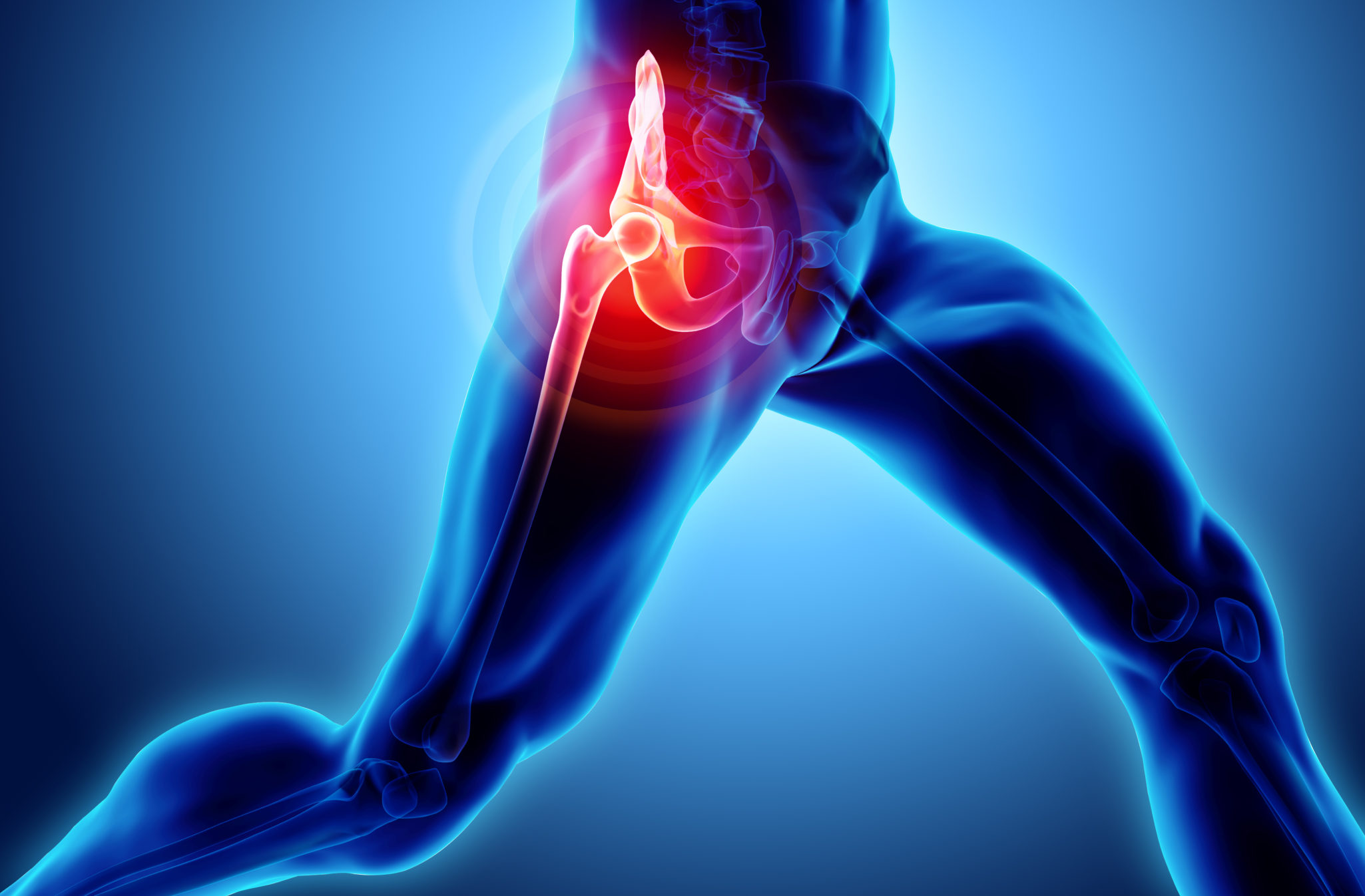 Modern Joint Replacement is More Comfortable and Effective - Orthopedic ...